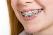 ortodoncia en Vitoria | Clínica Dental Amalthea
